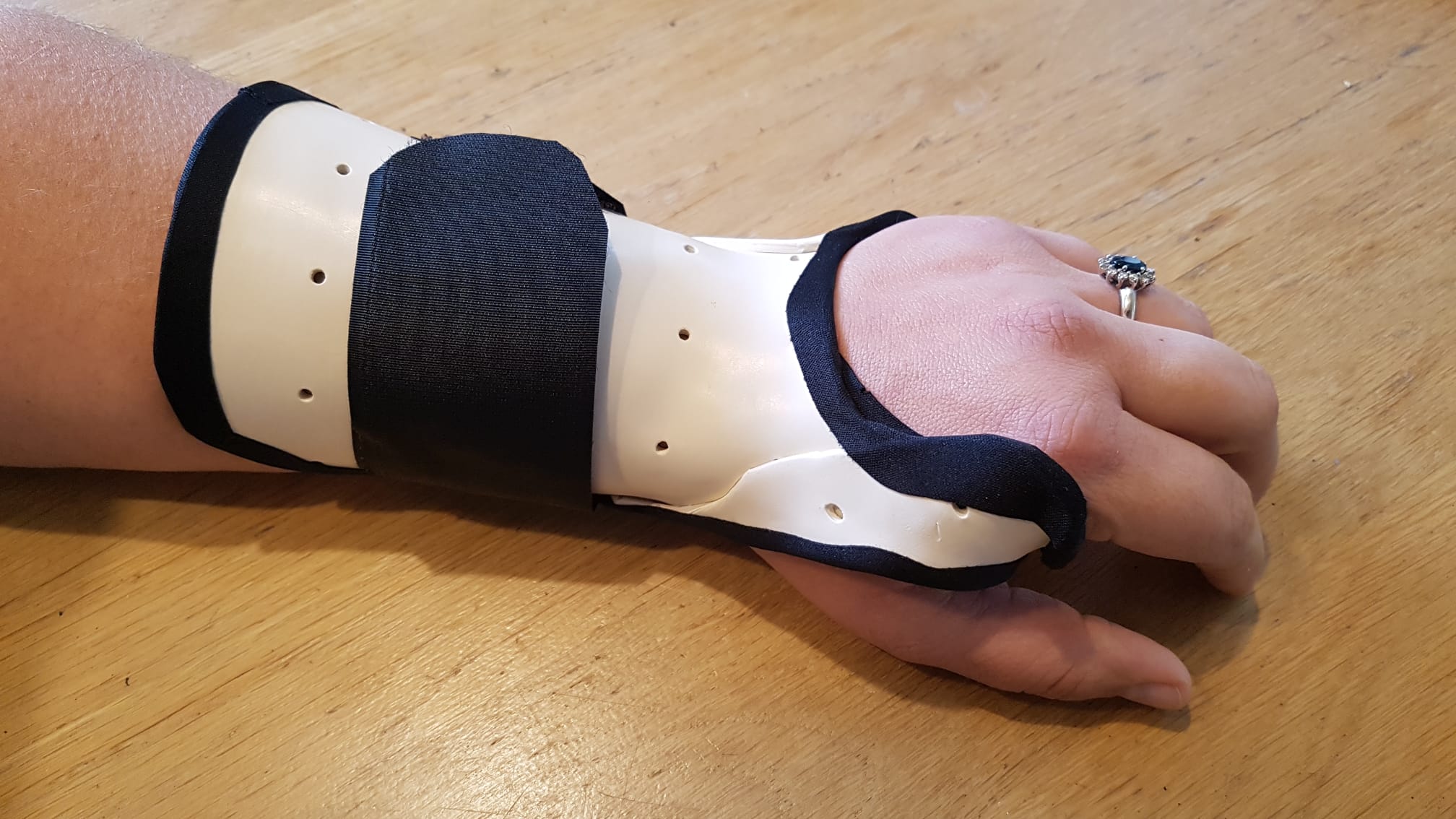 Orthèses de main – Orthophysio